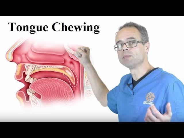 How reliable is the "sing" technique? : r/Mewing